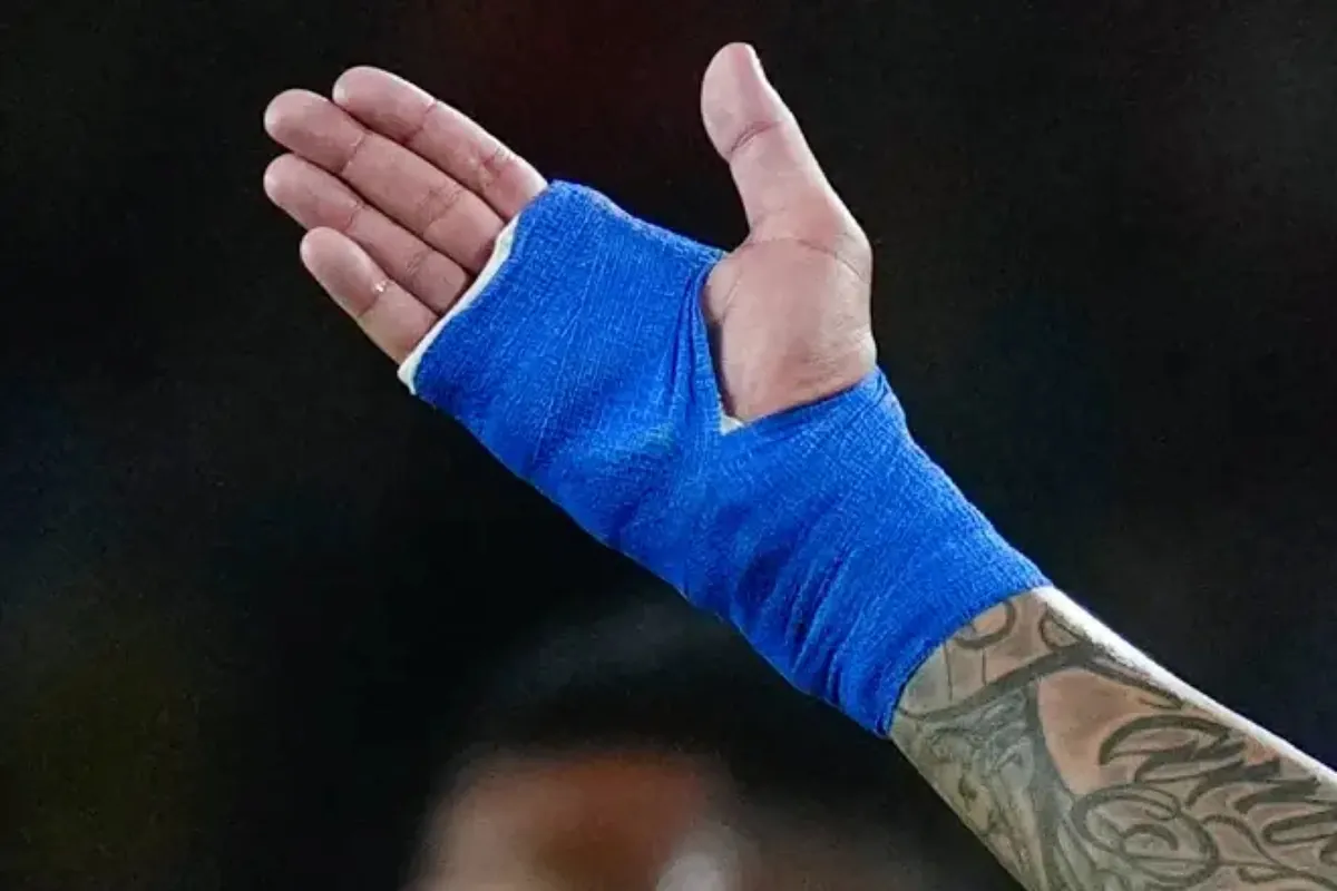 New superstitious theory about the mystery of the bandages used by ...